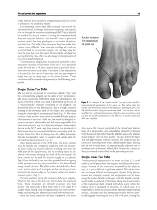 Toe and Partial Foot Amputations | PDF