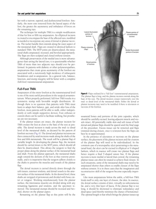 Toe and Partial Foot Amputations | PDF