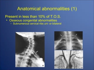THORACIC OUTLET SYNDROM (TOS) | PPT