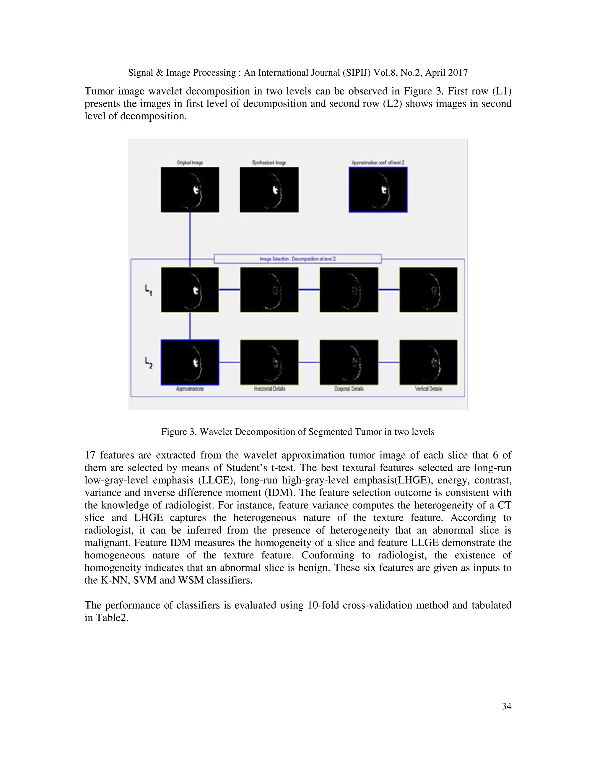 Malignant And Benign Brain Tumor Segmentation And Classification Using