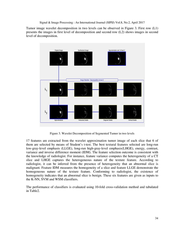 MALIGNANT AND BENIGN BRAIN TUMOR SEGMENTATION AND CLASSIFICATION USING SVM WITH WEIGHTED KERNEL ...