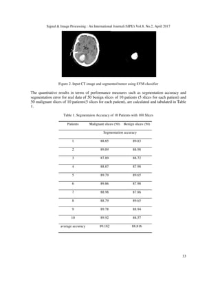 MALIGNANT AND BENIGN BRAIN TUMOR SEGMENTATION AND CLASSIFICATION USING SVM WITH WEIGHTED KERNEL ...