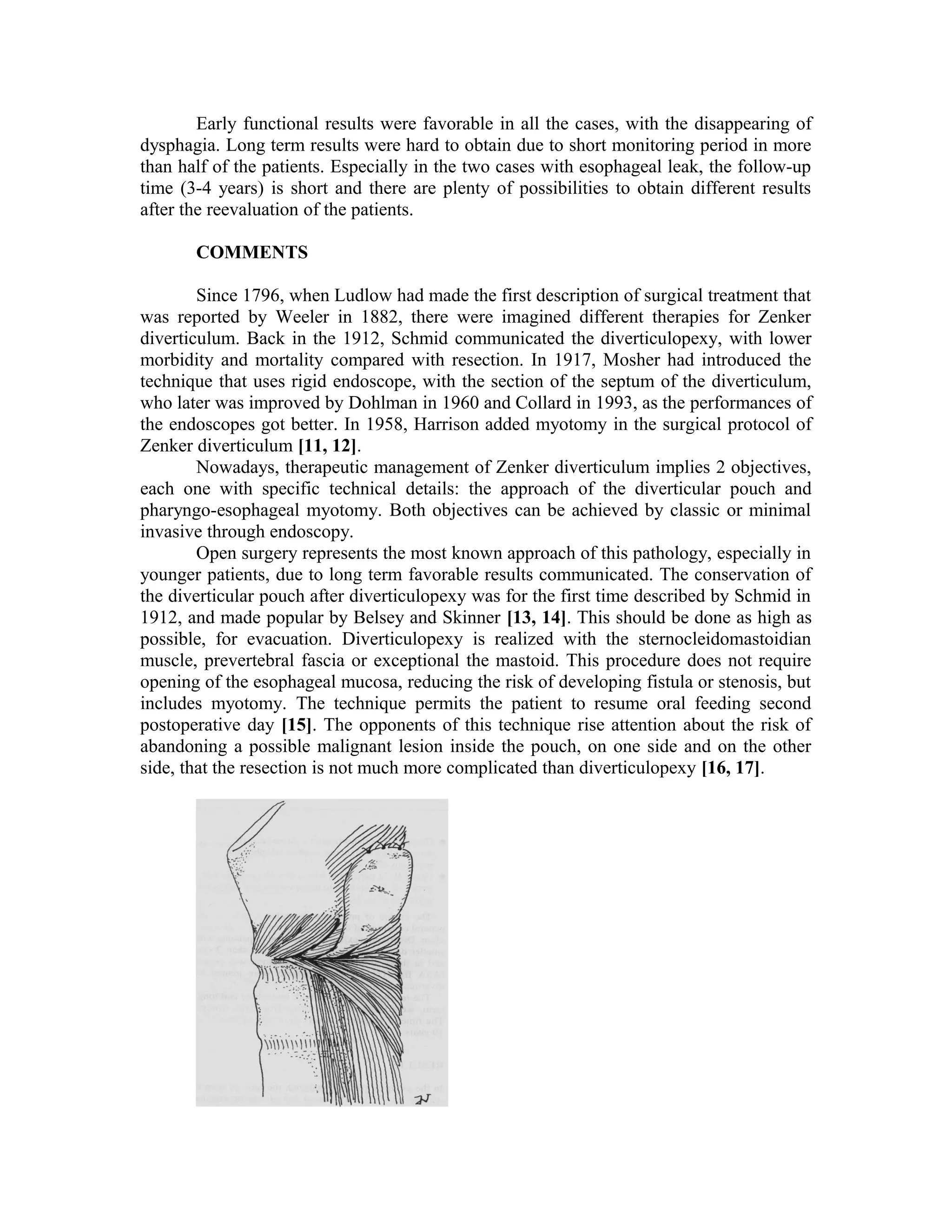 82185612 principles-of-surgical-treatment-of-zenker-diverticulum | DOC