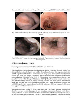 STRUCTURAL DYNAMICSAND EVOLUTION OFCAPSULE ENDOSCOPY (PILL CAMERA ...