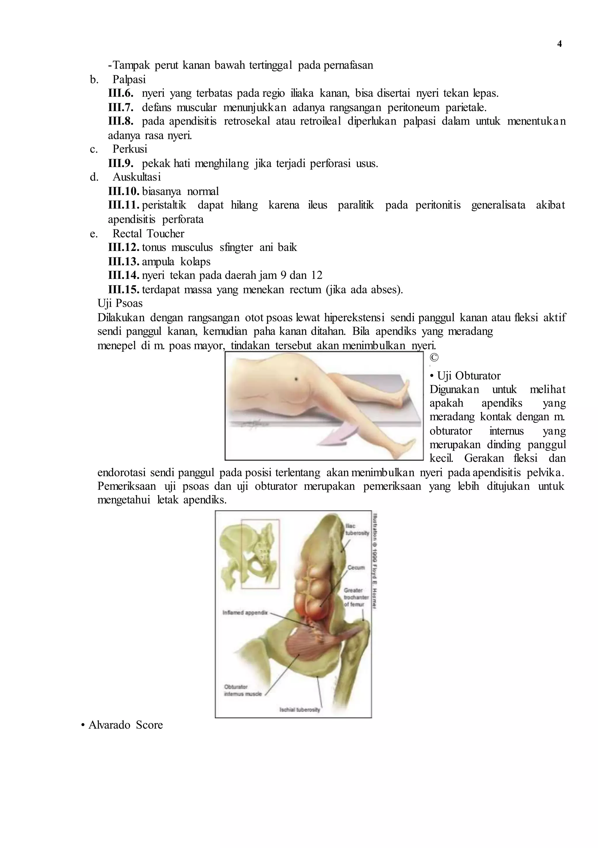 82894087 makalah-jadi-apendisitis | DOCX