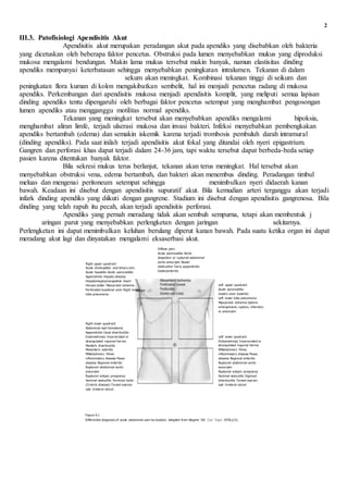 82894087 makalah-jadi-apendisitis | PDF