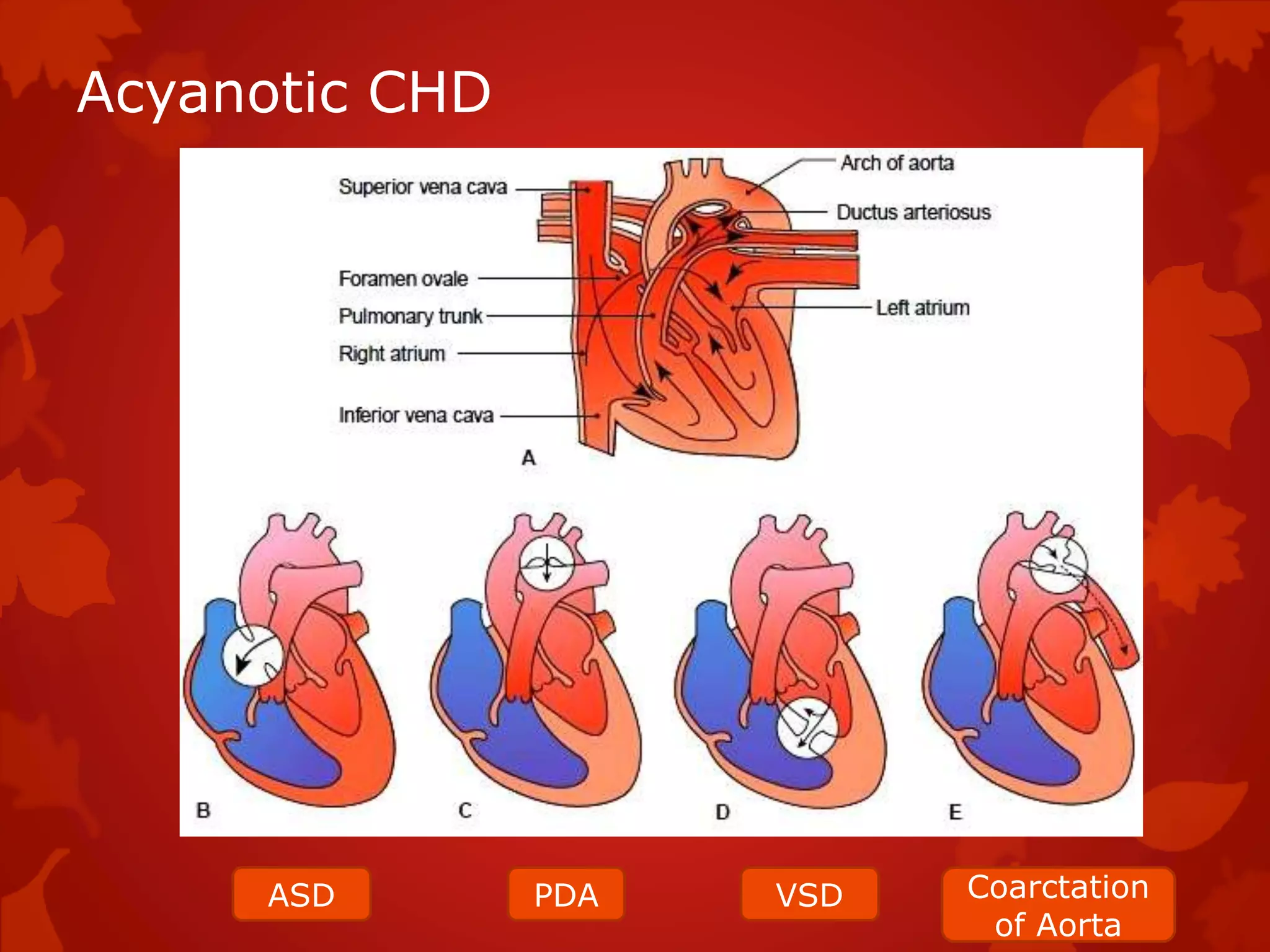 Nutrition In Children | PPTX