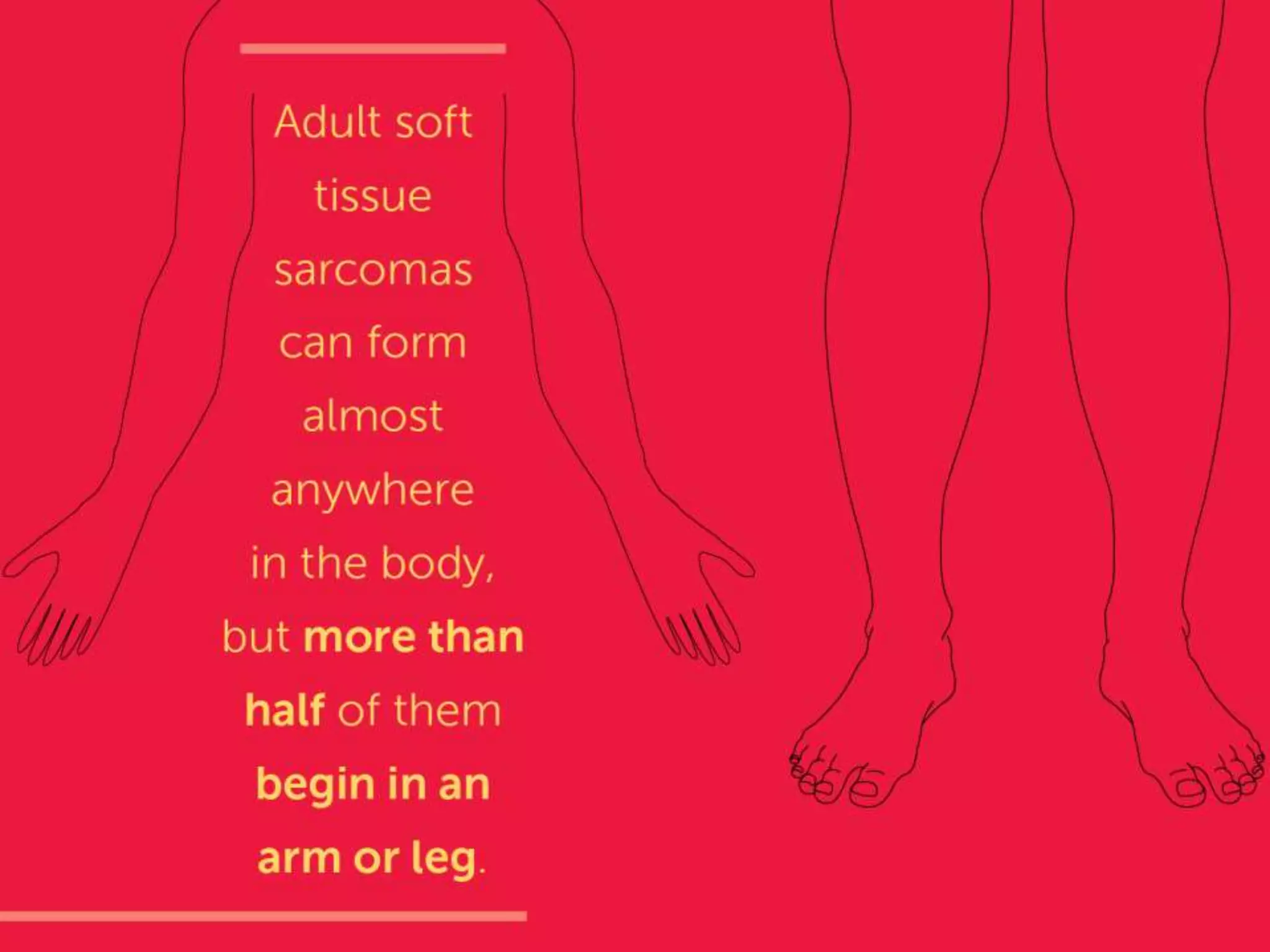 Soft Tissue Sarcomas: Symptoms and Risk Factors | PPTX