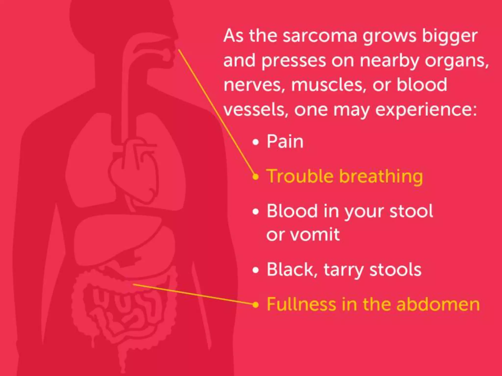 Soft Tissue Sarcomas: Symptoms and Risk Factors | PPTX