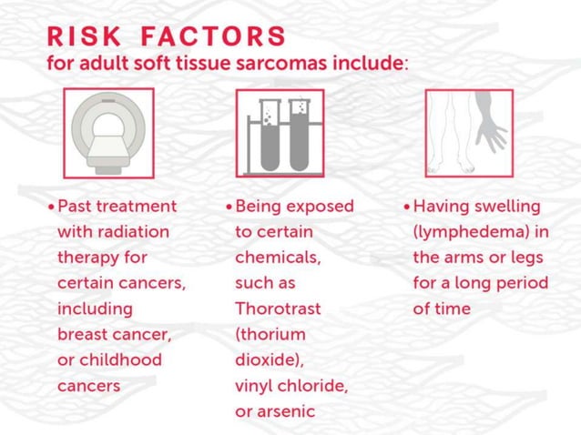 Soft Tissue Sarcomas: Symptoms and Risk Factors