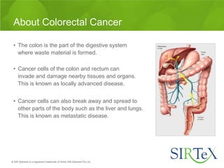 Intro to SIR-Spheres® microspheres | PPTX