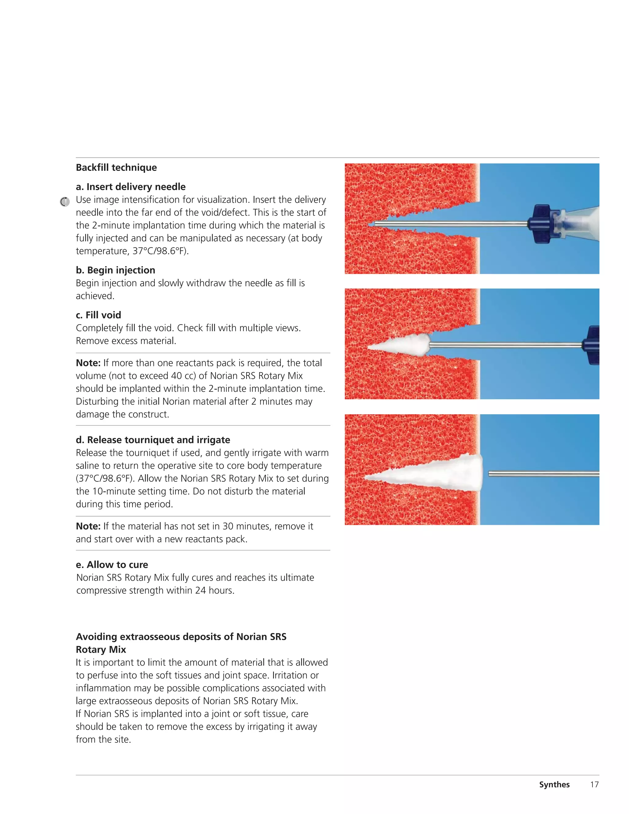 Norian SRS Rotary Mix | PDF