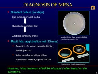 SCOURGE_OF_MRSA_97-2003 | PPT | Skin and Dermatology | Diseases and ...