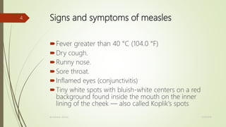 measles by ahmad | PPTX