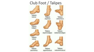 846_Arches_of_Foot and thier importance.pptx