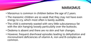 Protein Energy Malnutrition.pptx