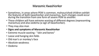 Protein Energy Malnutrition.pptx