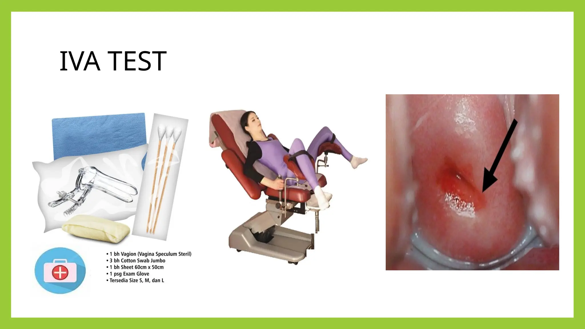 848708763-Materi-Penyuluhan-Iva-Test.pptx