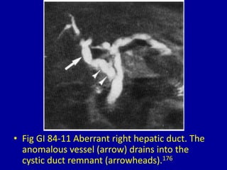 84 magnetic resonance cholangiography | PPT