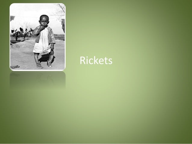 Rickets