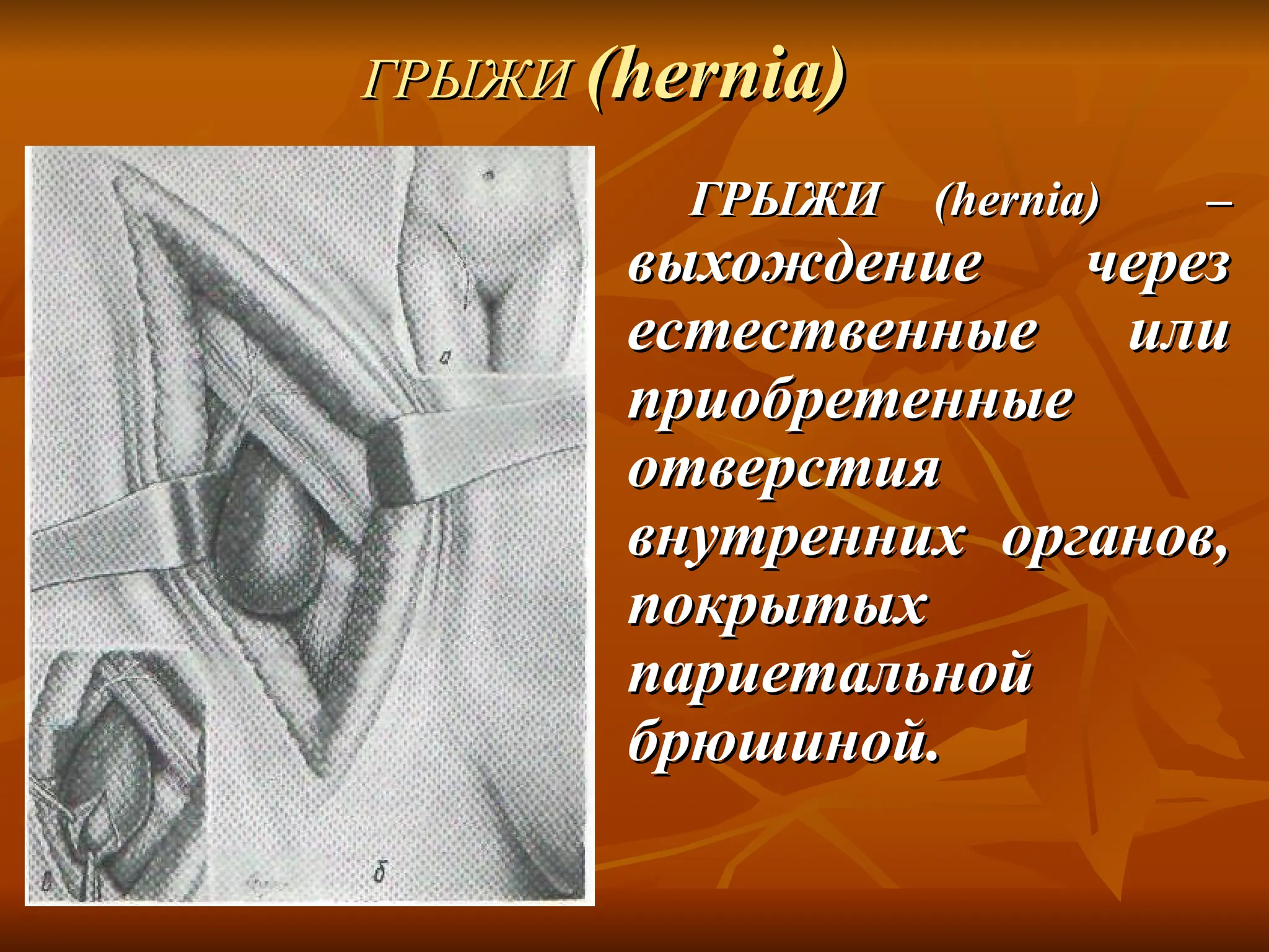 topanat - abdominable lecture on hernia and femoral ring | PPT