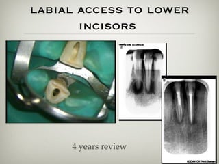 msc impact presentation | PPT