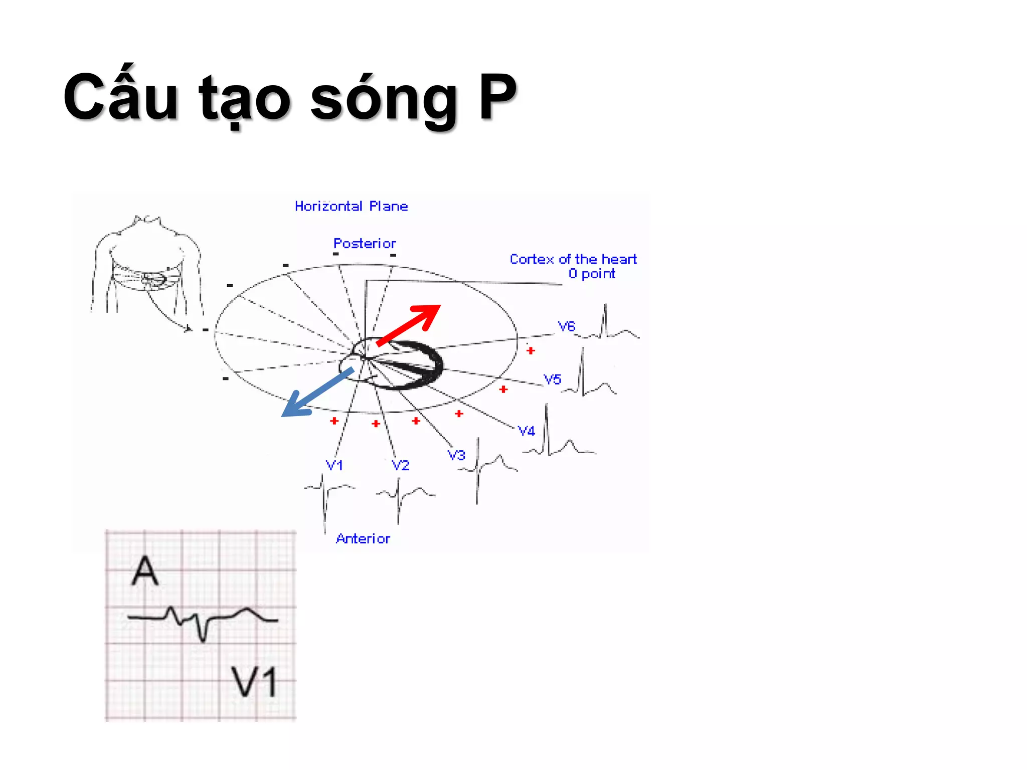 ECG TRONG LỚN NHĨ THẤT | PDF