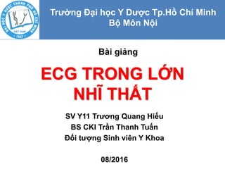 ECG TRONG LỚN NHĨ THẤT | PDF