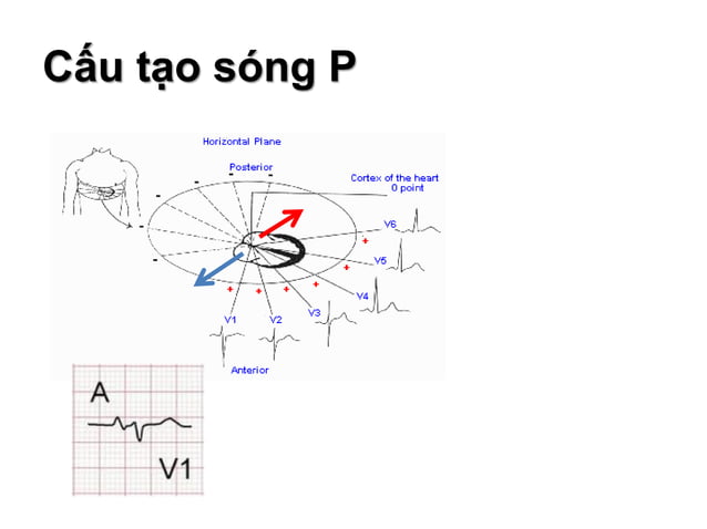 ECG TRONG LỚN NHĨ THẤT | PDF