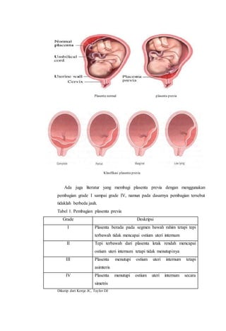 86345062 makalah-plasenta-previa | PDF
