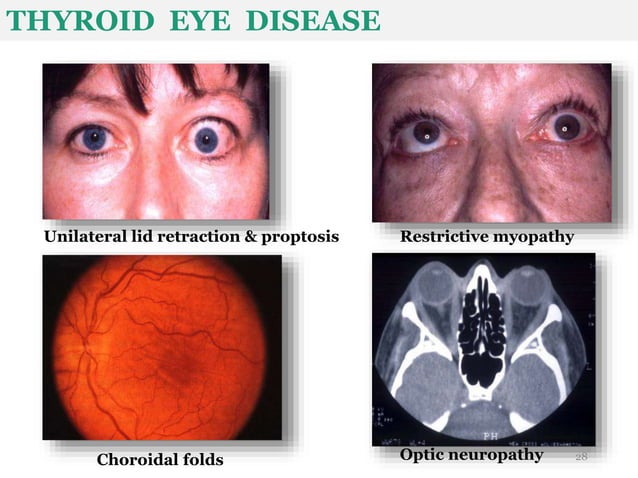 865_Ocular_manifestations_of_systemic_ds..pptx