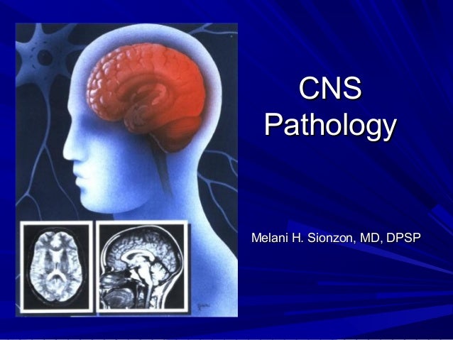8679901 central-nervous-system-pathology