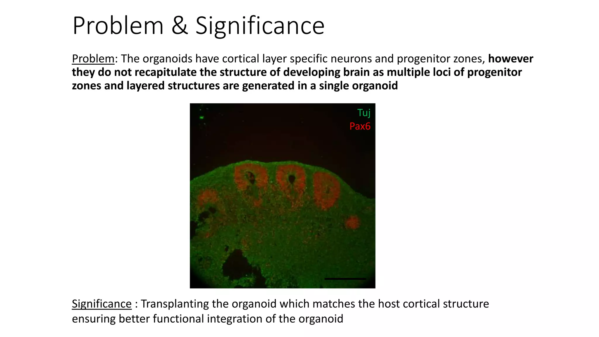 ChenLab_Rotation_Presentation | PPTX | Brain and Nervous System Disorders | Diseases and Conditions