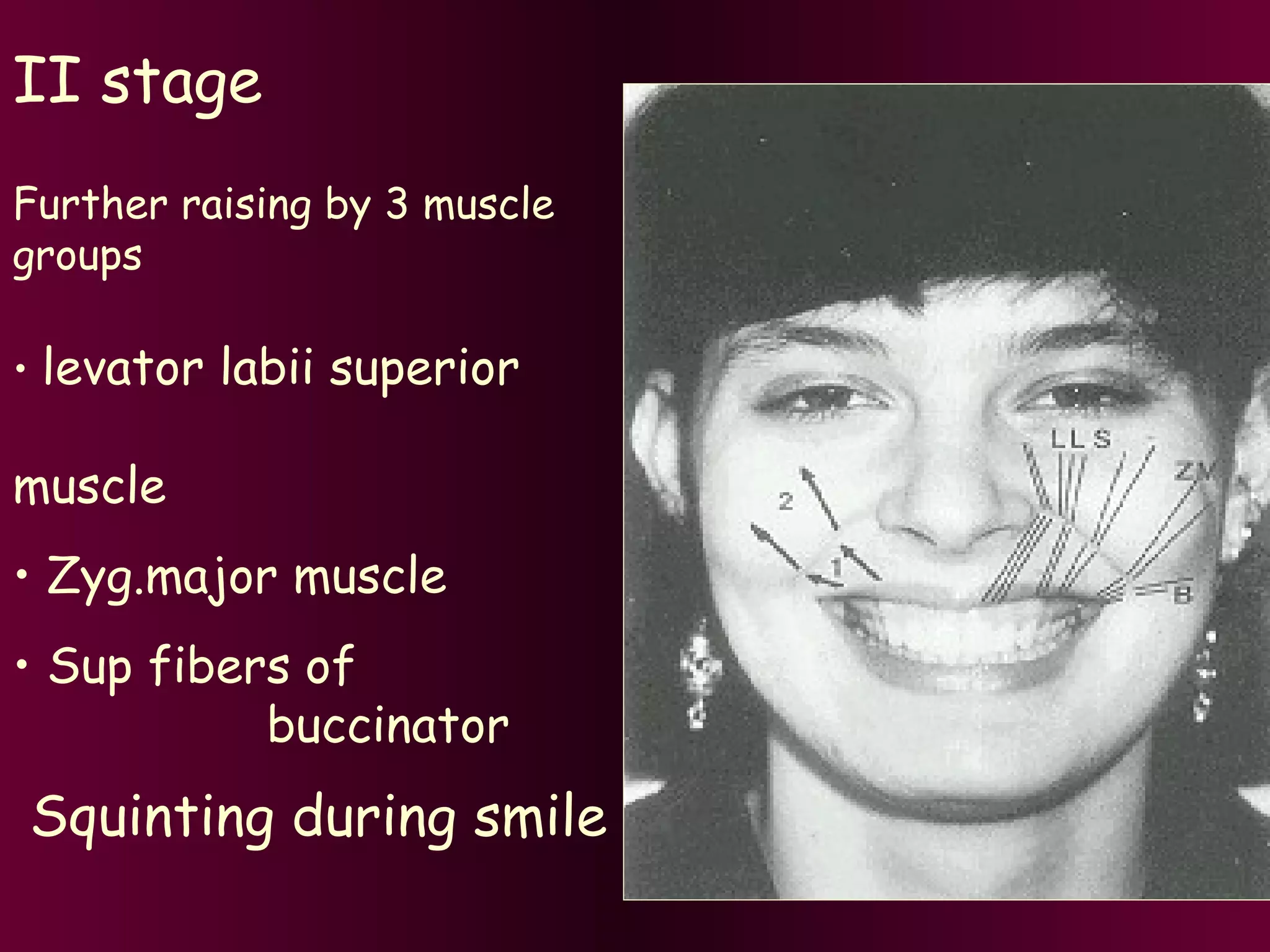 The smile line and its importance in treatment planning | PPT | Dental ...