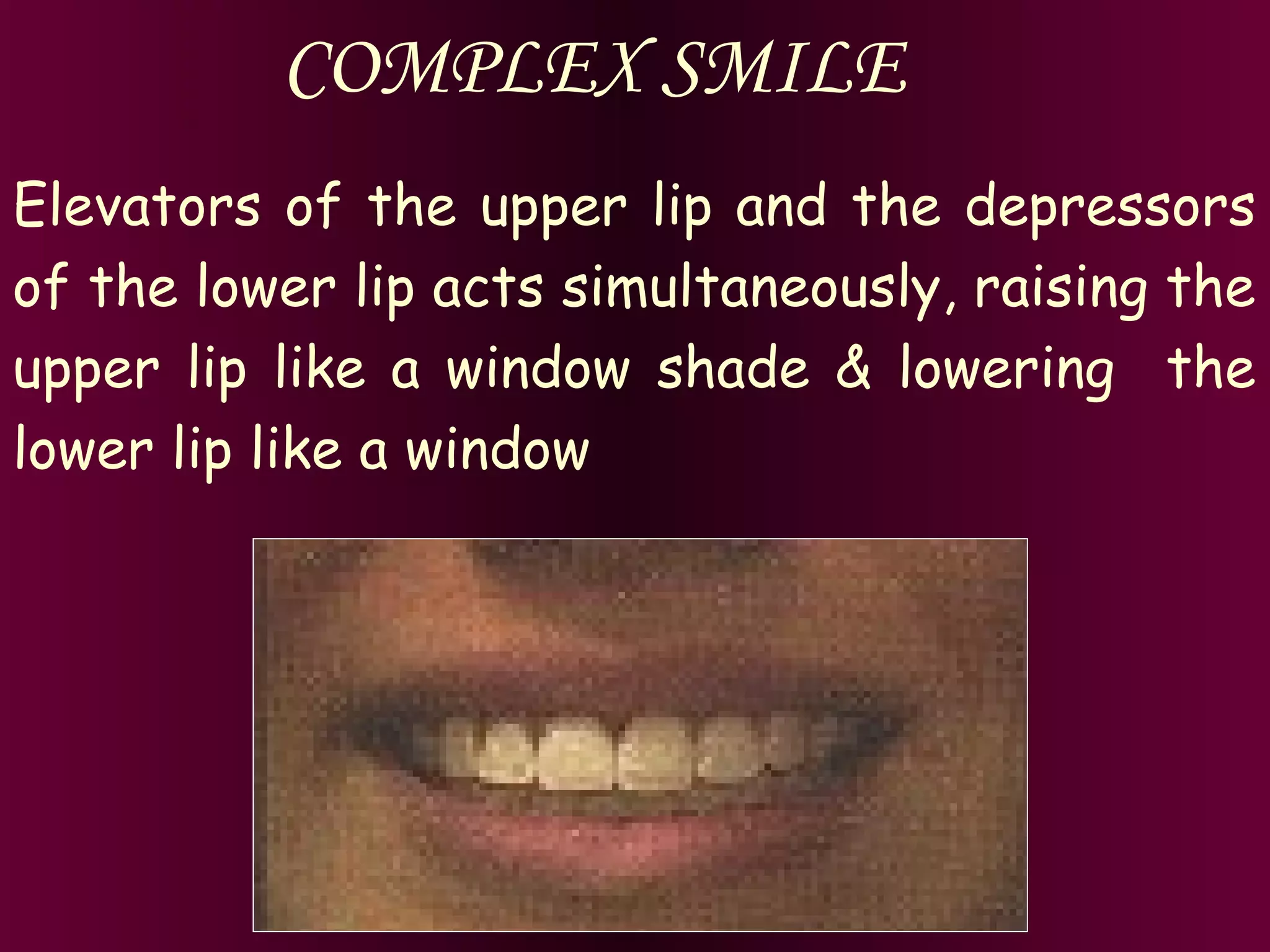 The smile line and its importance in treatment planning | PPT | Dental ...