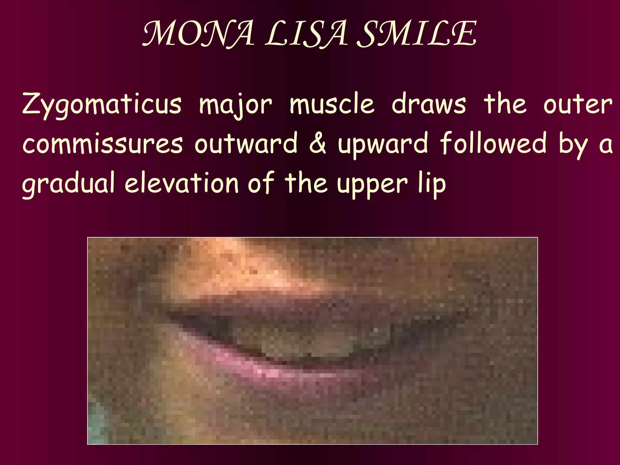 The smile line and its importance in treatment planning | PPT | Dental ...