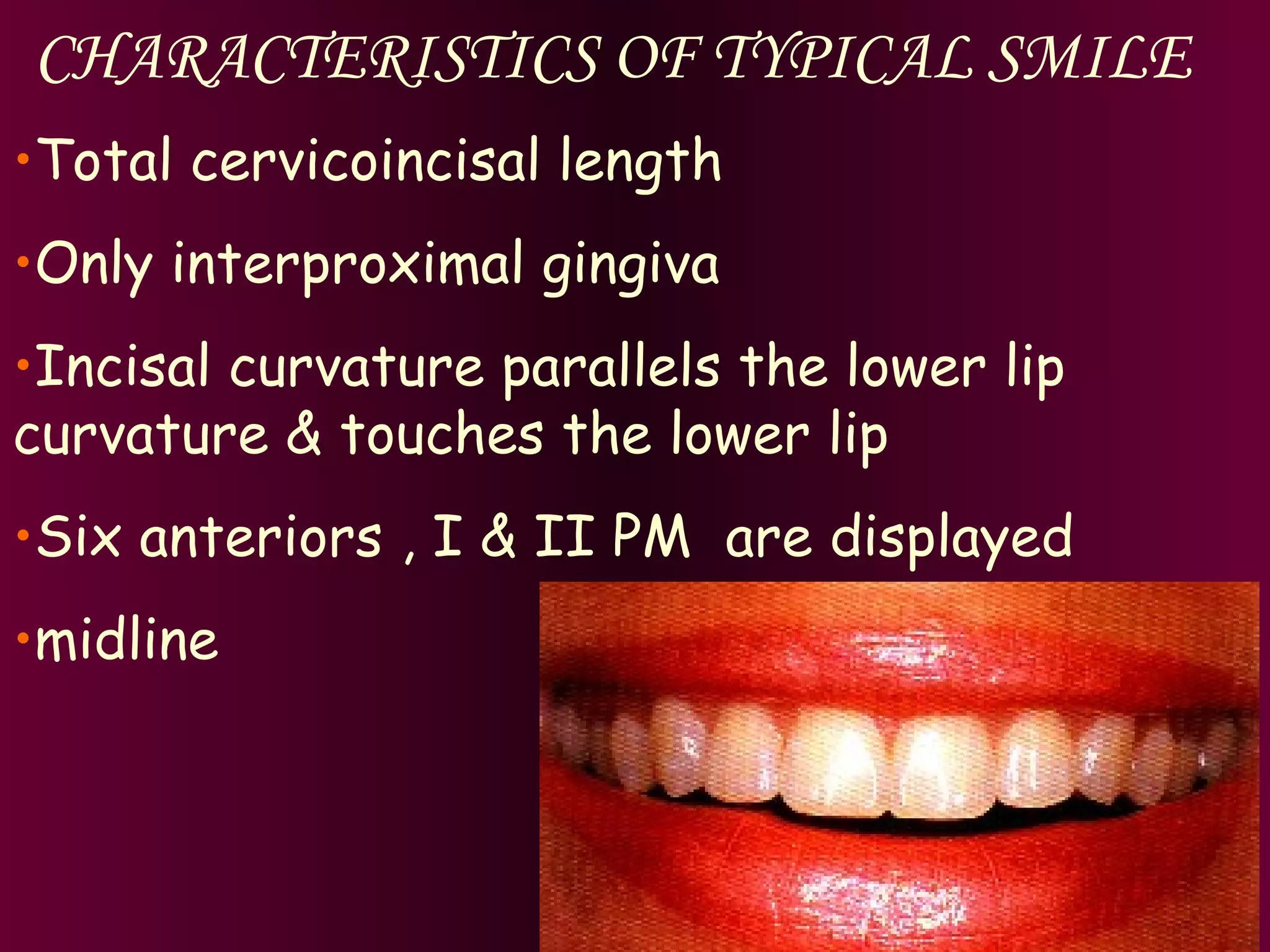 The smile line and its importance in treatment planning | PPT | Dental ...