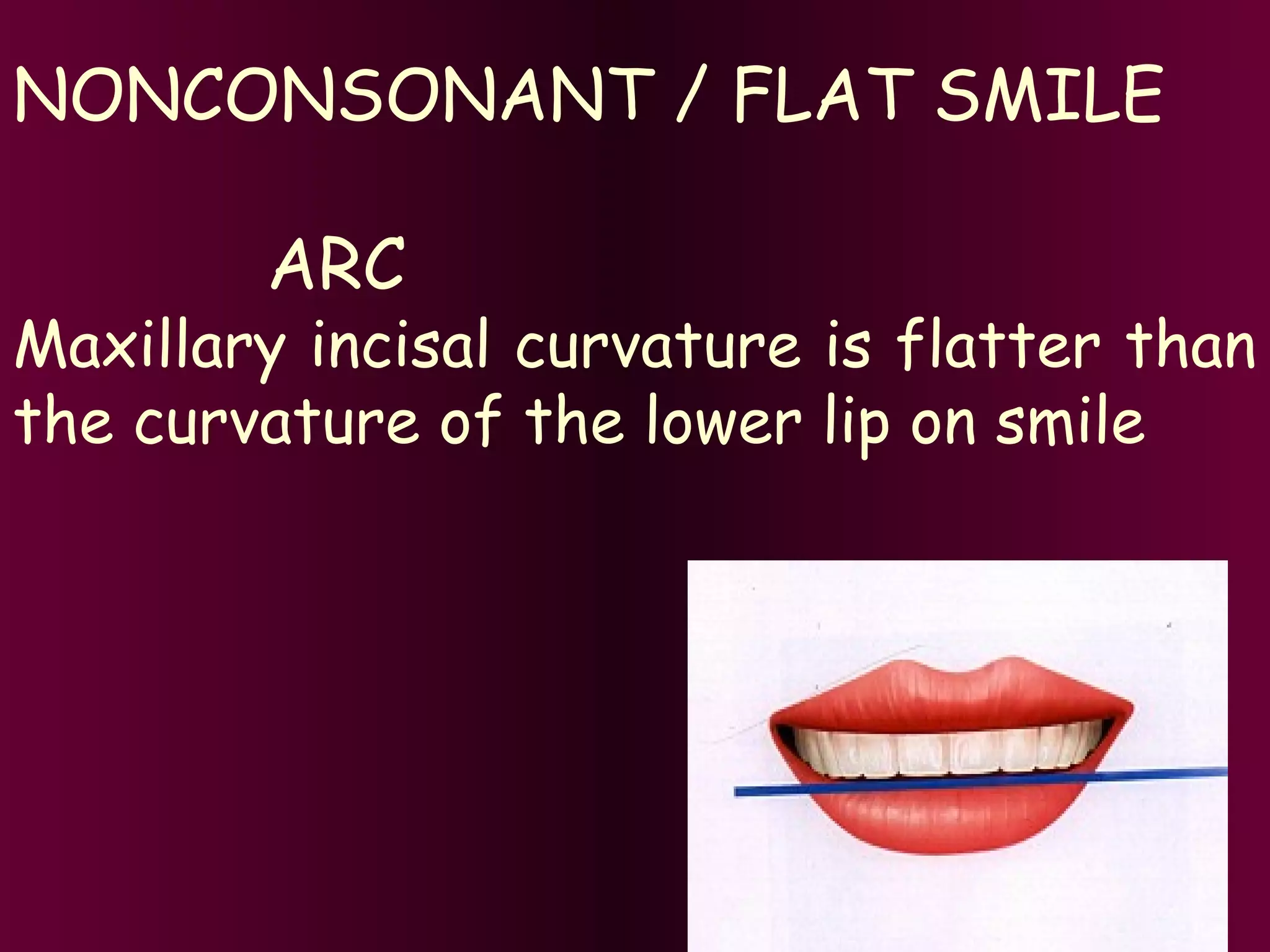 The smile line and its importance in treatment planning | PPT | Dental ...