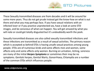 The #1 resource for STD pictures and photos | PPT
