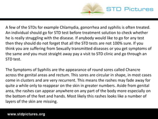 The #1 resource for STD pictures and photos | PPTX