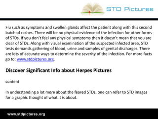 The #1 resource for STD pictures and photos | PPTX