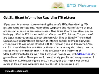 The #1 resource for STD pictures and photos | PPTX
