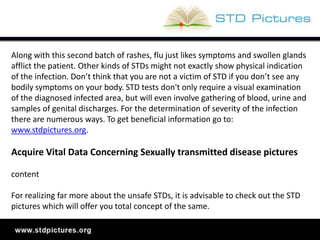 The #1 resource for STD pictures and photos | PPTX