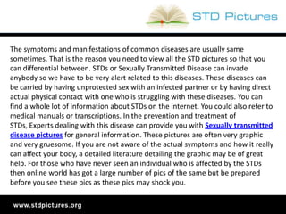The #1 resource for STD pictures and photos | PPTX