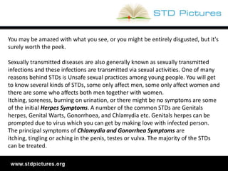 The #1 resource for STD pictures and photos | PPTX