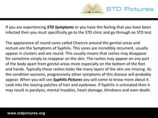The #1 resource for STD pictures and photos | PPTX