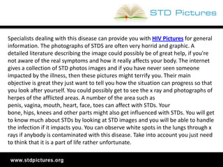 The #1 resource for STD pictures and photos | PPTX