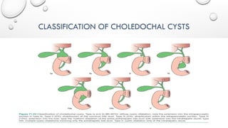 872479337-Congenital-Anomalies-of-Gallbladder-and-Bile-Duct.pptx