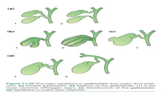 872479337-Congenital-Anomalies-of-Gallbladder-and-Bile-Duct.pptx