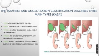 872479337-Congenital-Anomalies-of-Gallbladder-and-Bile-Duct.pptx